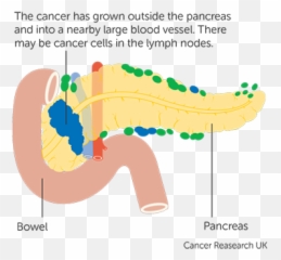 Download Lol Center Stage Glitter - Center Stage Lol Doll Printable Lol ...